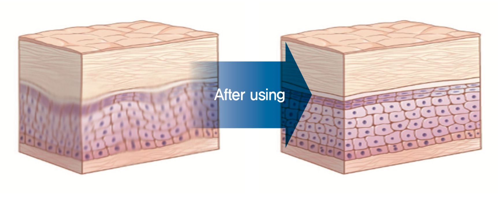 Transform Your Skin with Kiara Reju Skin Booster – Celesta Korea